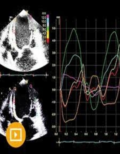 Echocardiography – A Comprehensive Review 2022 cme videos – medicinfor